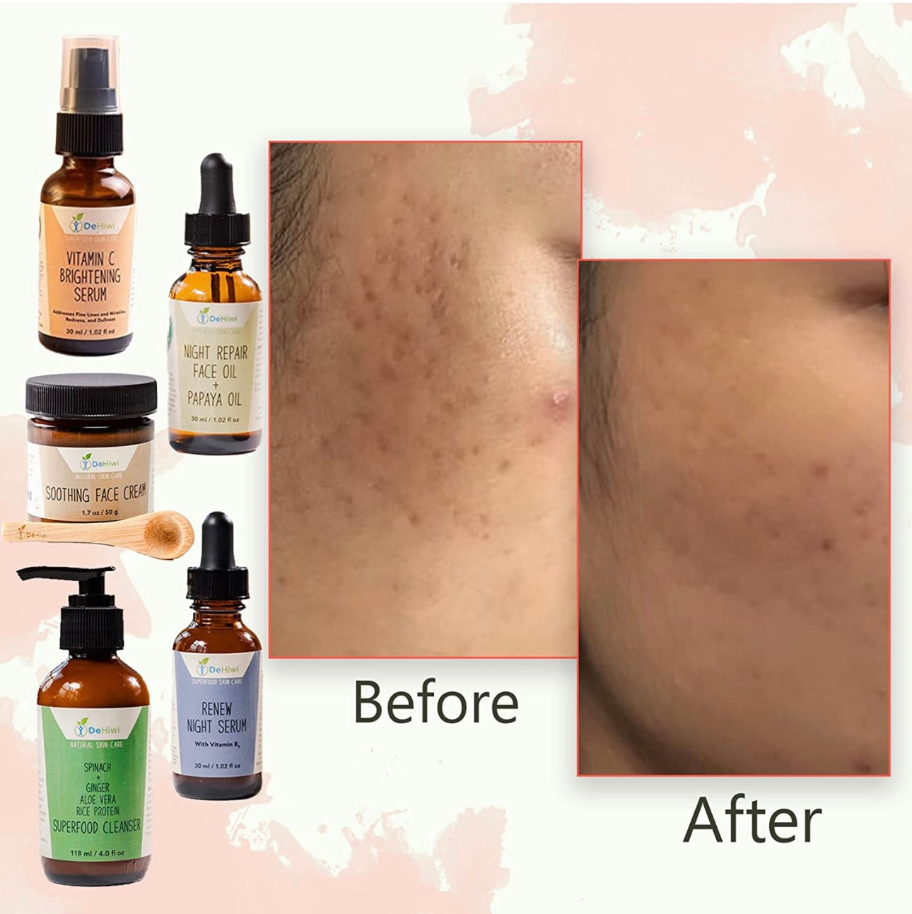 Dark Spot Essentials – DeHiwi Care